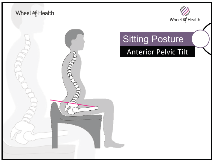 The importance of good wheelchair choice and posture