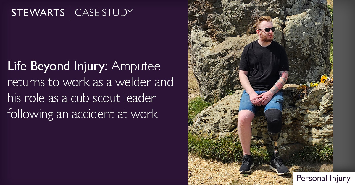 Life Beyond Injury: Amputee returns to work as a welder and his role as ...
