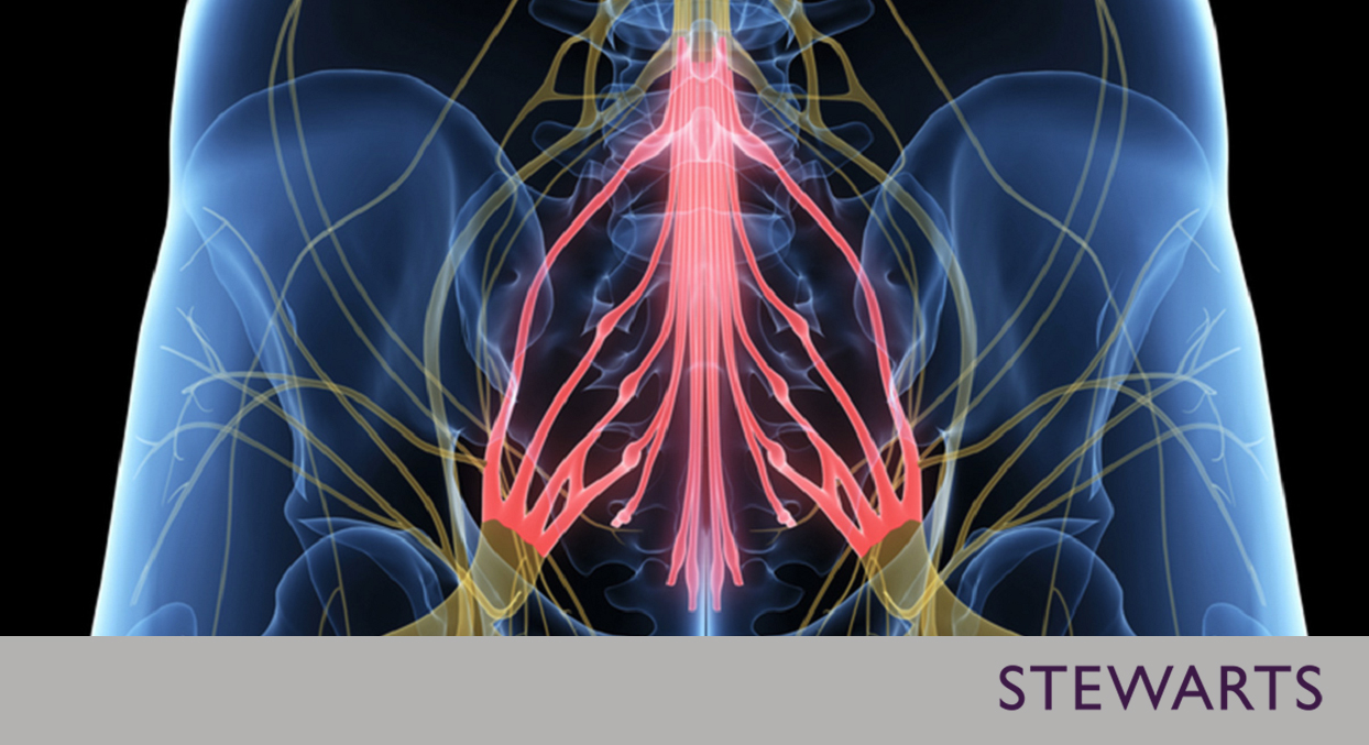 Medicolegal experts explain cauda equina syndrome & symptoms